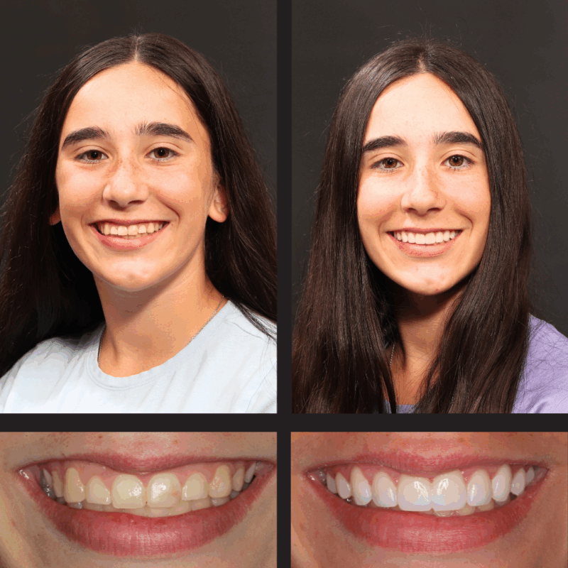 Smile Gallery - Rochester Advanced Dentistry