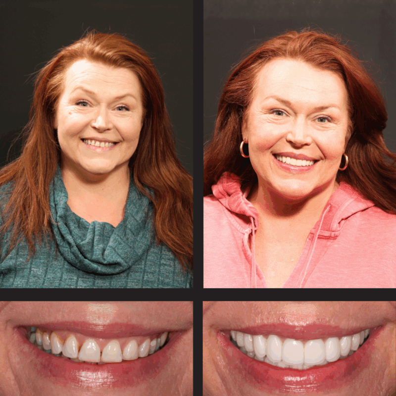 Smile Gallery - Rochester Advanced Dentistry