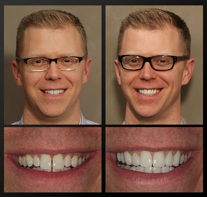 Smile Gallery - Rochester Advanced Dentistry